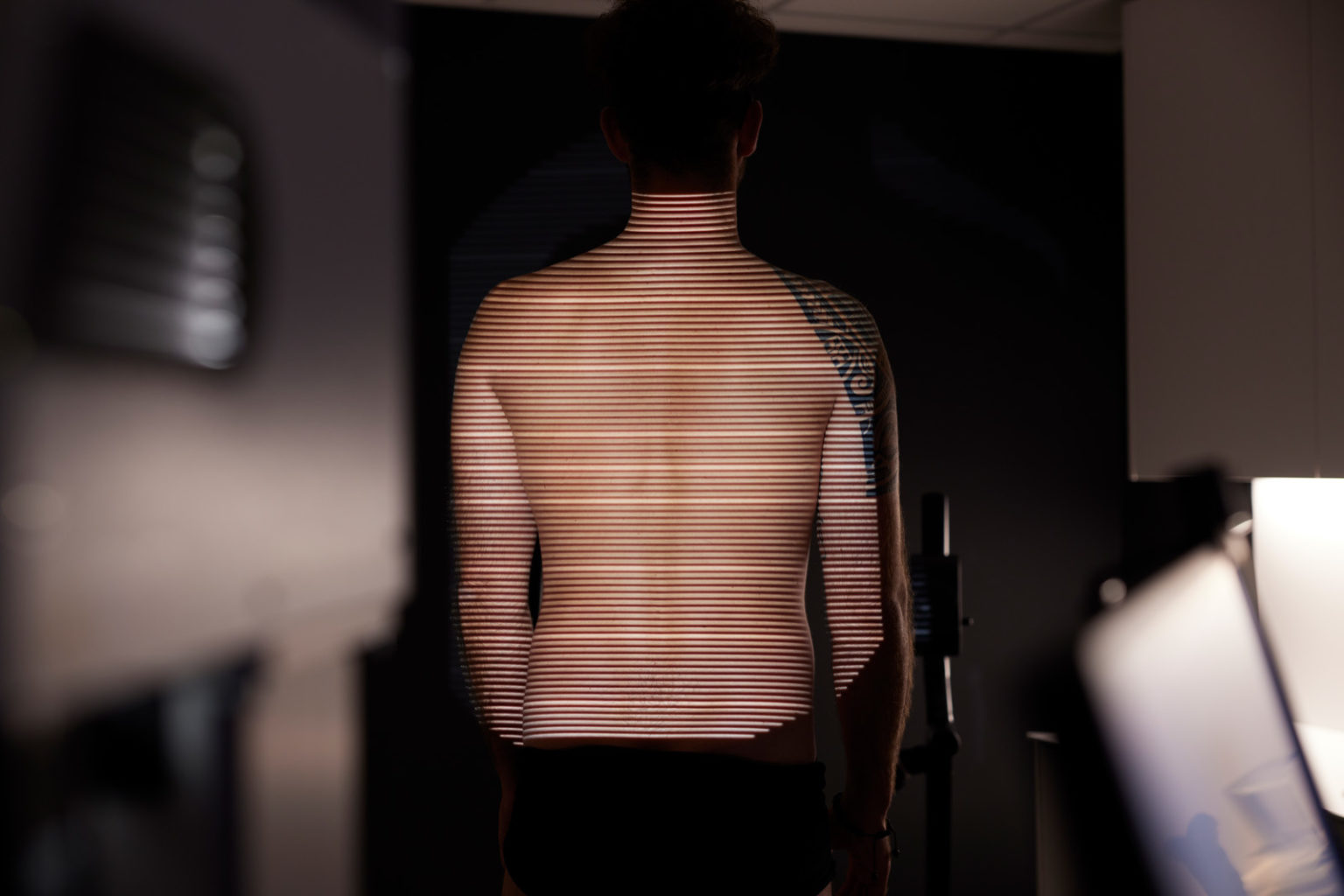 Orthopädie Dortmund: 4D-Wirbelsäulenvermessung